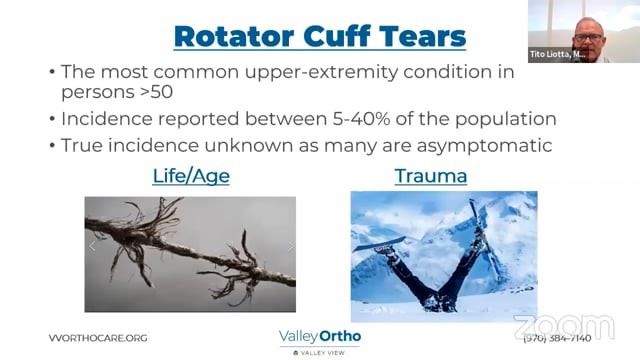 Dr. Liotta - Rotator Cuff Injuries & Treatments | Valley View Hospital ...